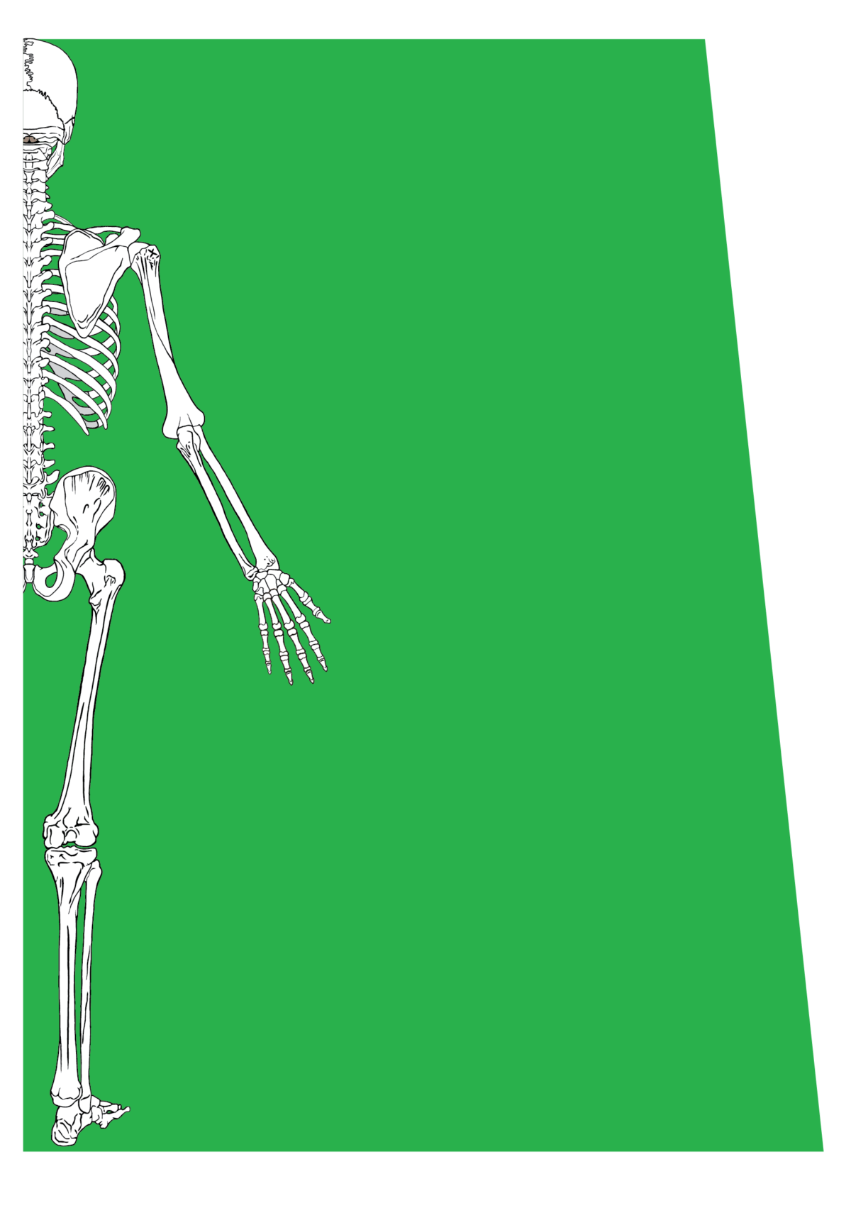 Distal Clavicle Excision - orthofish