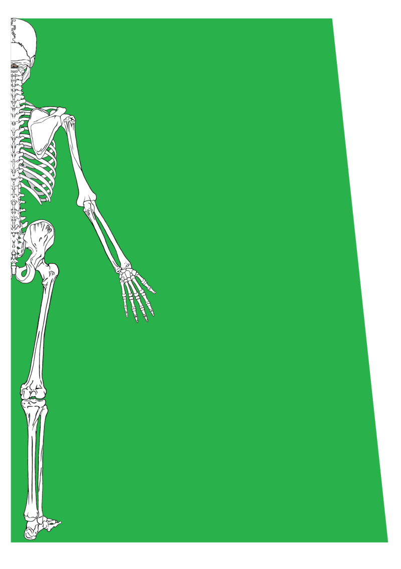 Distal Clavicle Excision - orthofish